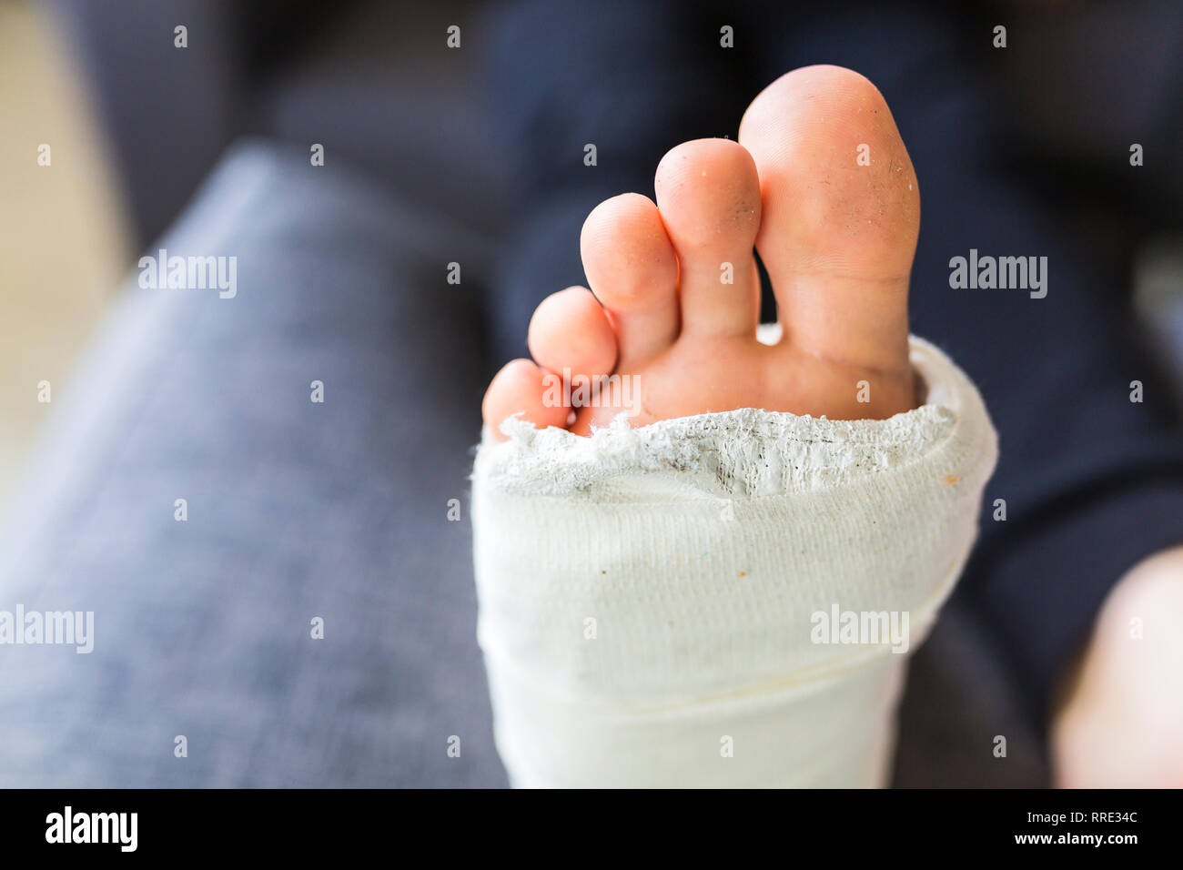 Fused body hi-res stock photography and images - Alamy