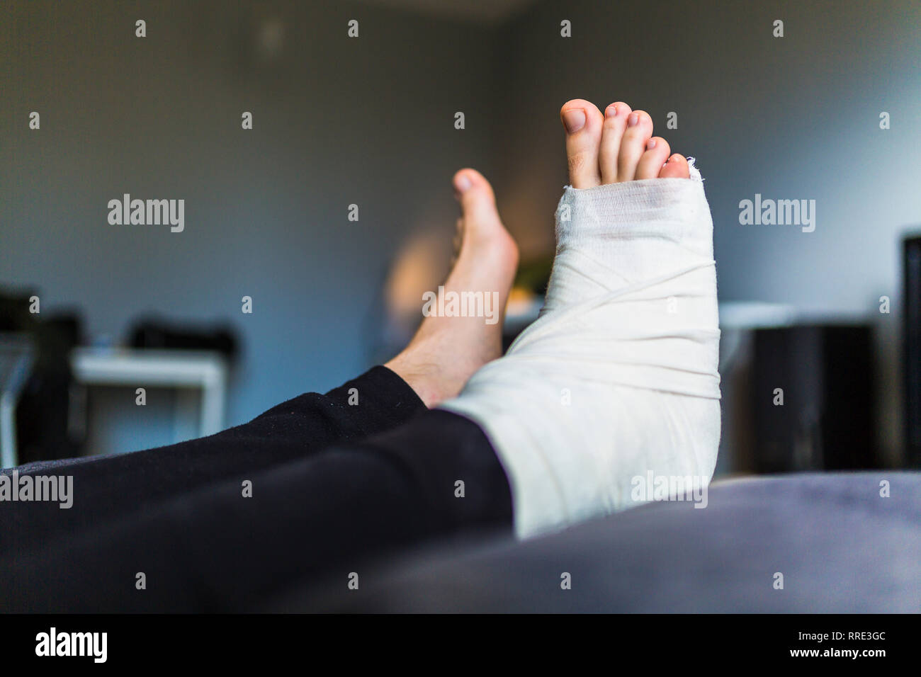 Broken leg hi-res stock photography and images - Alamy