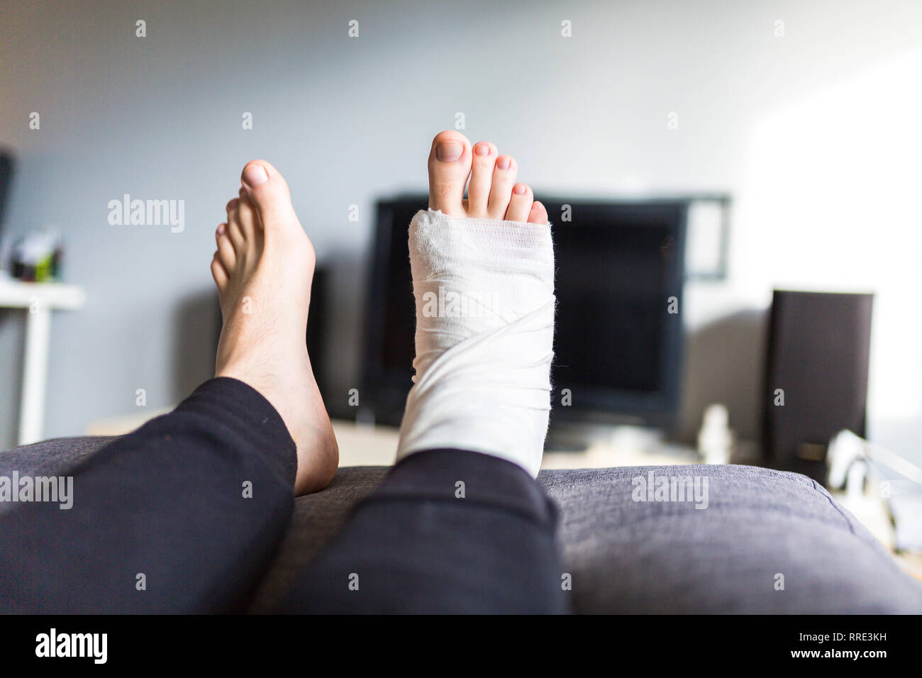 man in front of the TV with a broken leg Stock Photo - Alamy