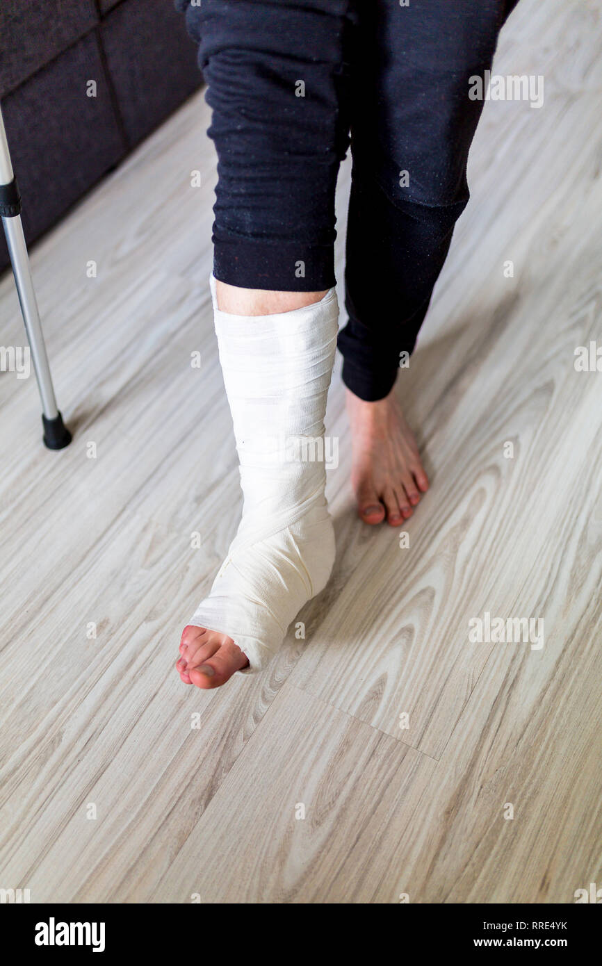 Plaster leg cast legs hi-res stock photography and images - Alamy