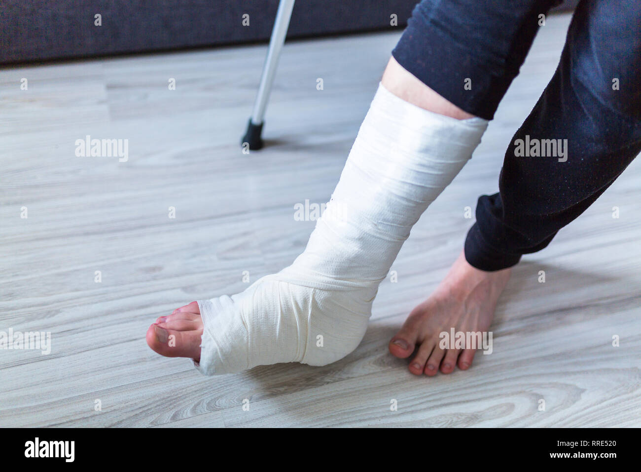 Broken leg hi-res stock photography and images - Alamy