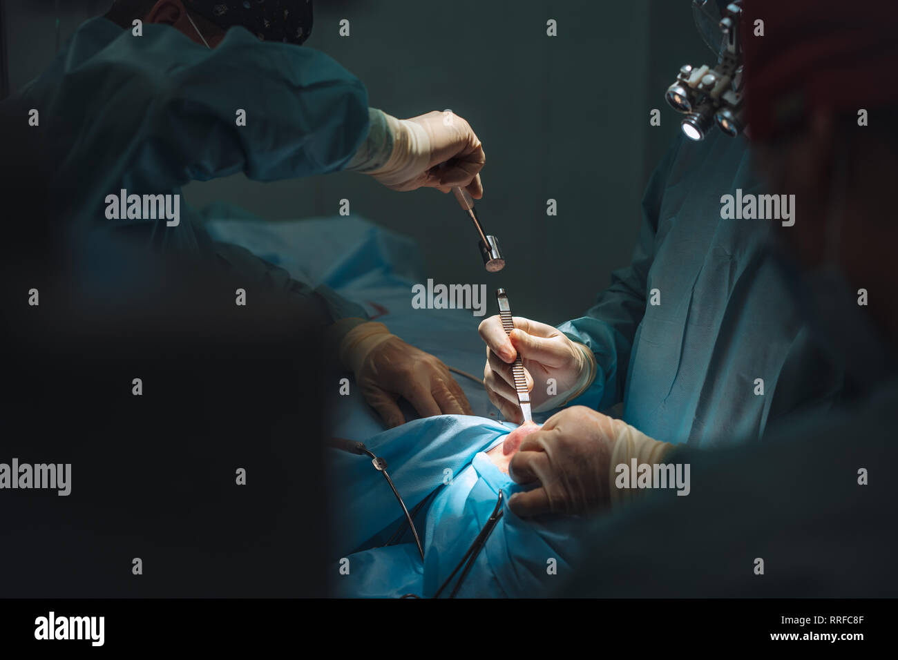 Rhinoplasty hammer hi-res stock photography and images - Alamy