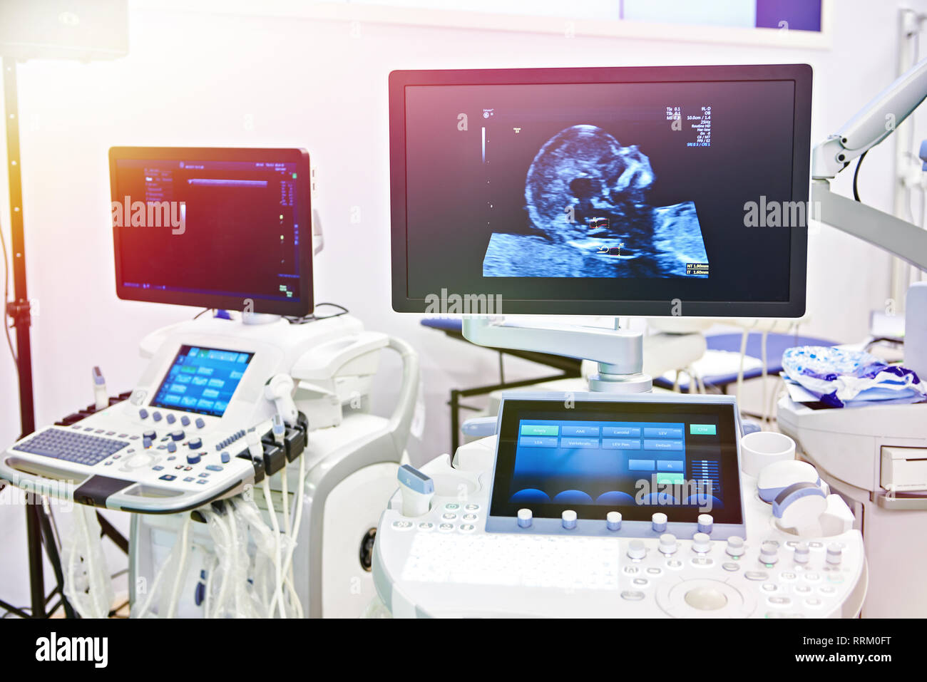 Head ultrasound hi-res stock photography and images - Alamy