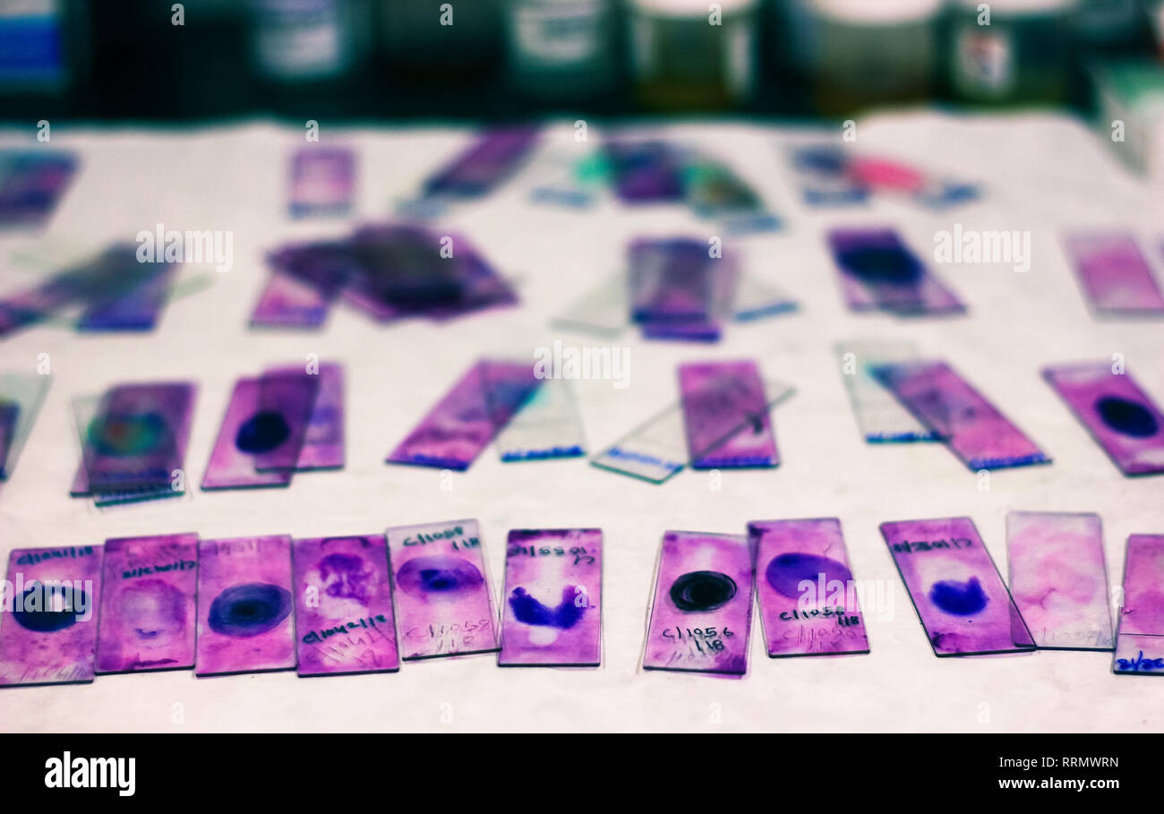 stained glass slides of peripheral blood smear with violet leishman ...