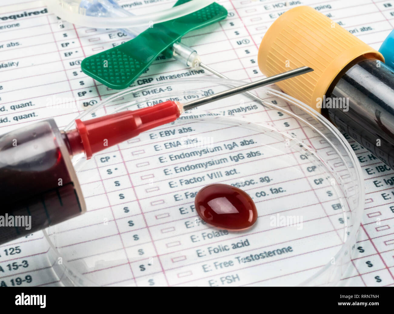 Blood agar hi-res stock photography and images - Alamy