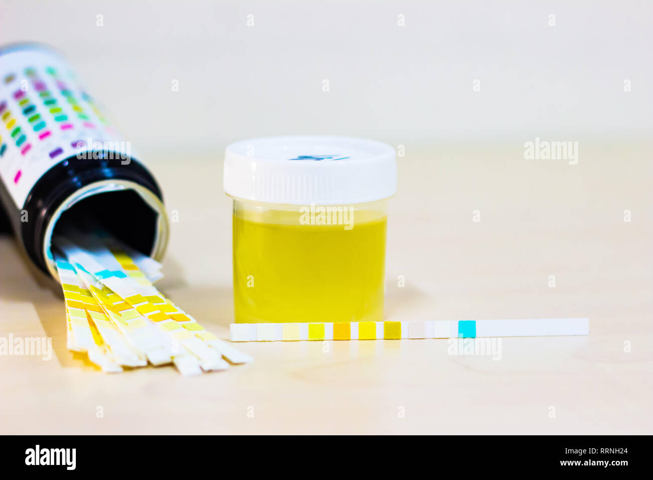 urine sample along with dip stick uristix for analyzing urine glucose ...