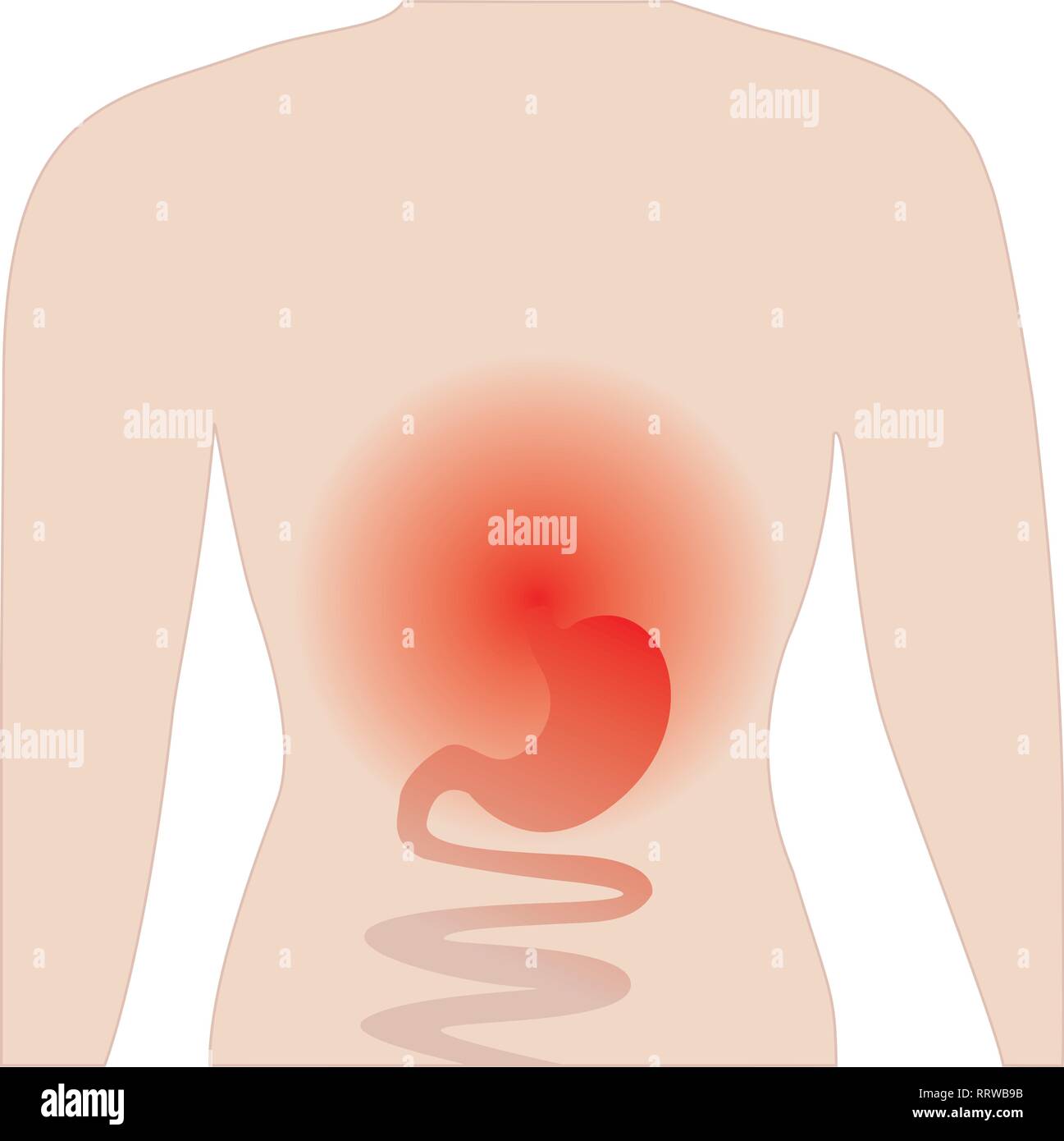Gastritis. aching stomach. Vector illustration on a white background ...
