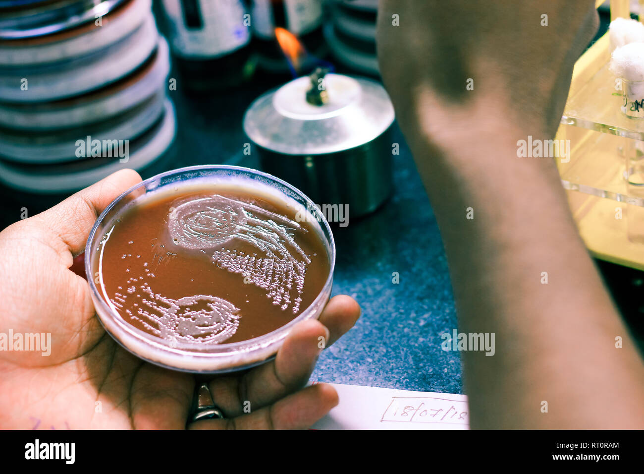 Bacterial Inoculation on a culture plate using inoculation loop by ...