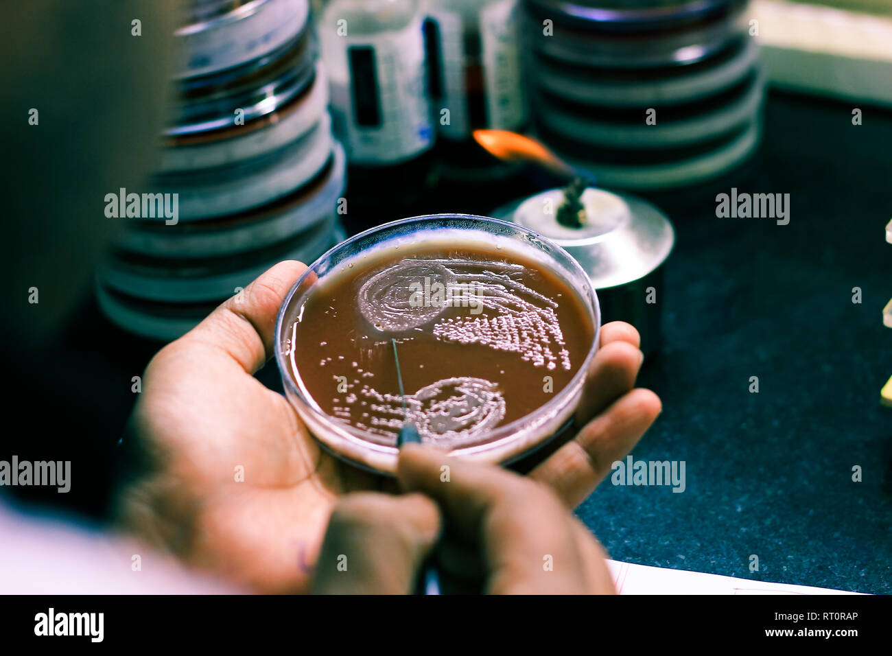 Bacterial Inoculation on a culture plate using inoculation loop by ...