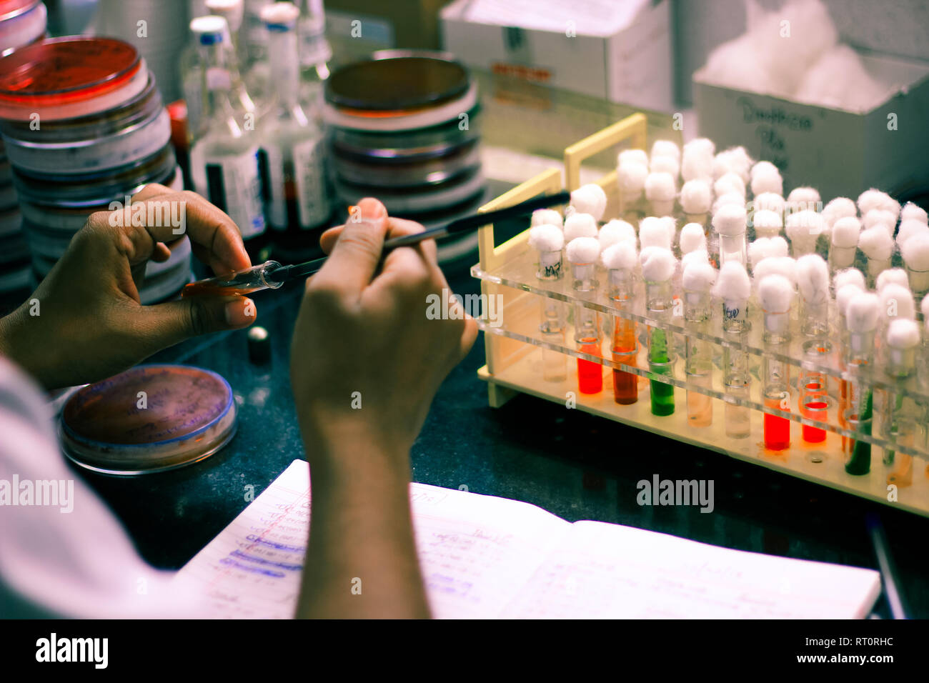 Inoculating loop hi-res stock photography and images - Alamy