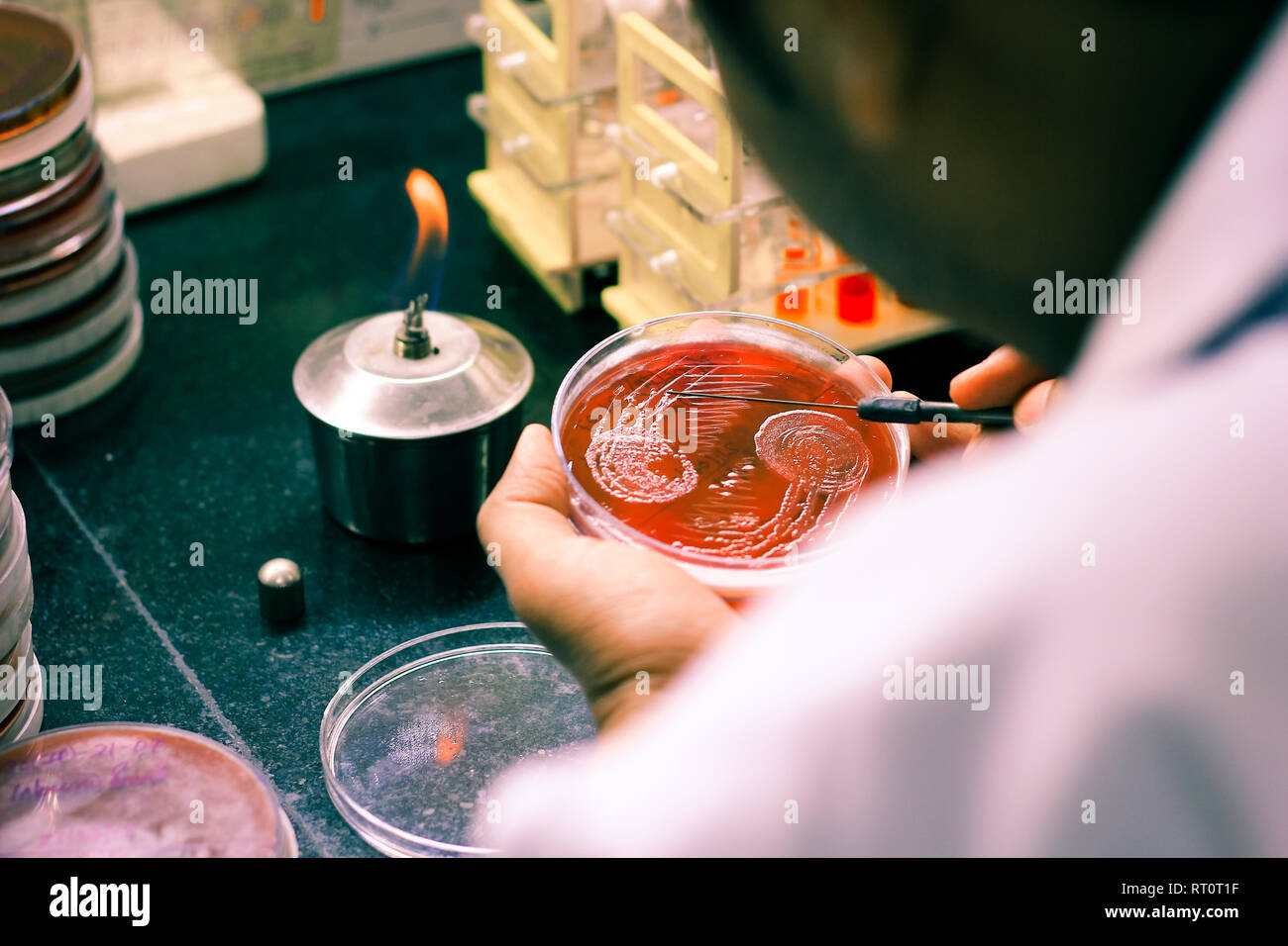 Bacterial Inoculation on a culture plate using inoculation loop by ...
