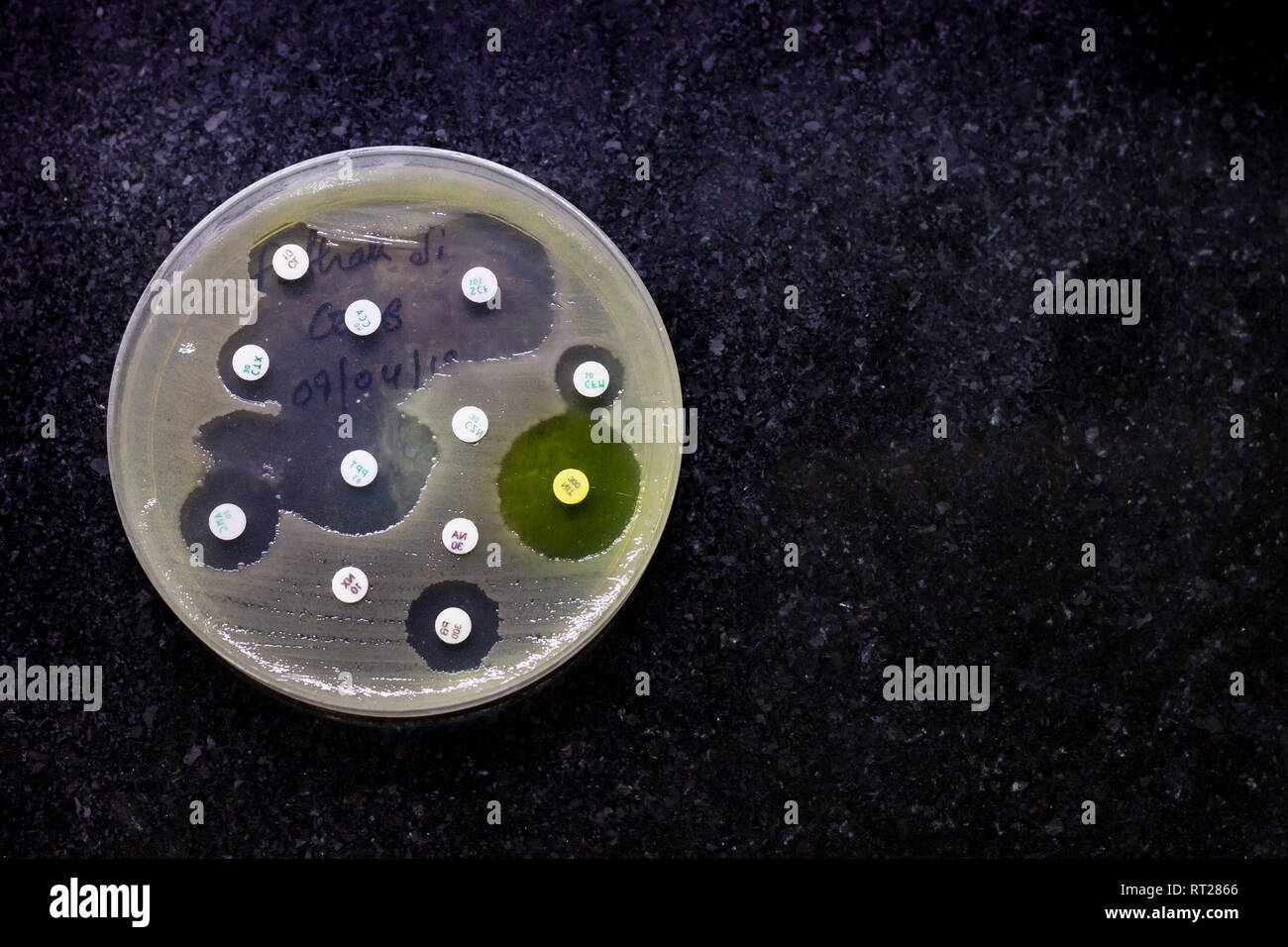 Top View of Culture plate of bacterial growth showing antibiotic ...