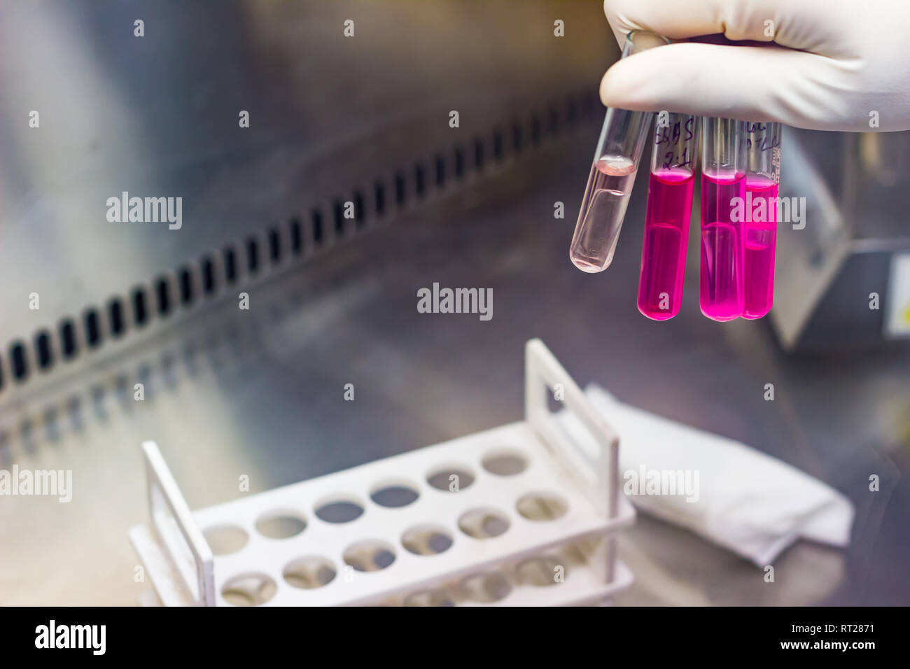 Durham's tube in Sugar media showing gas production by bacteria held in ...