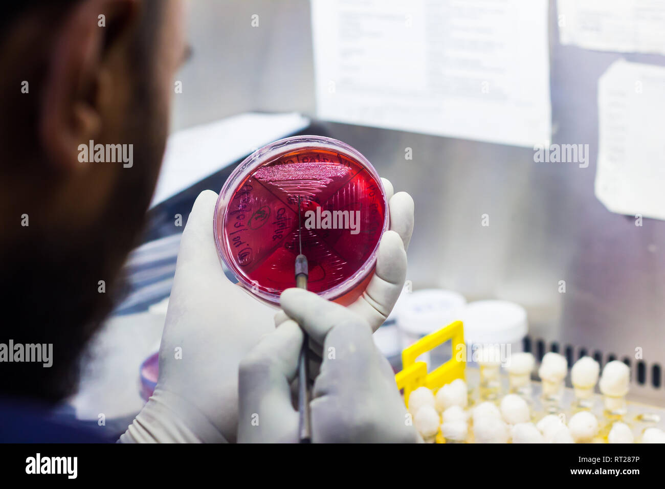 Bacterial Inoculation on a culture plate using inoculation loop by ...