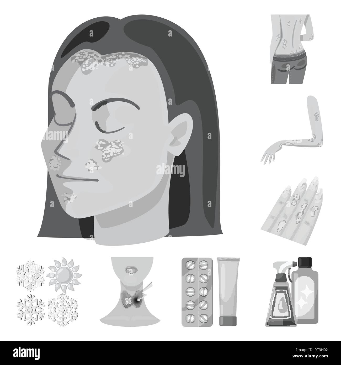 Psoriasis Snowflake Endocrine Pill Chemical Skin Dermatitis Body