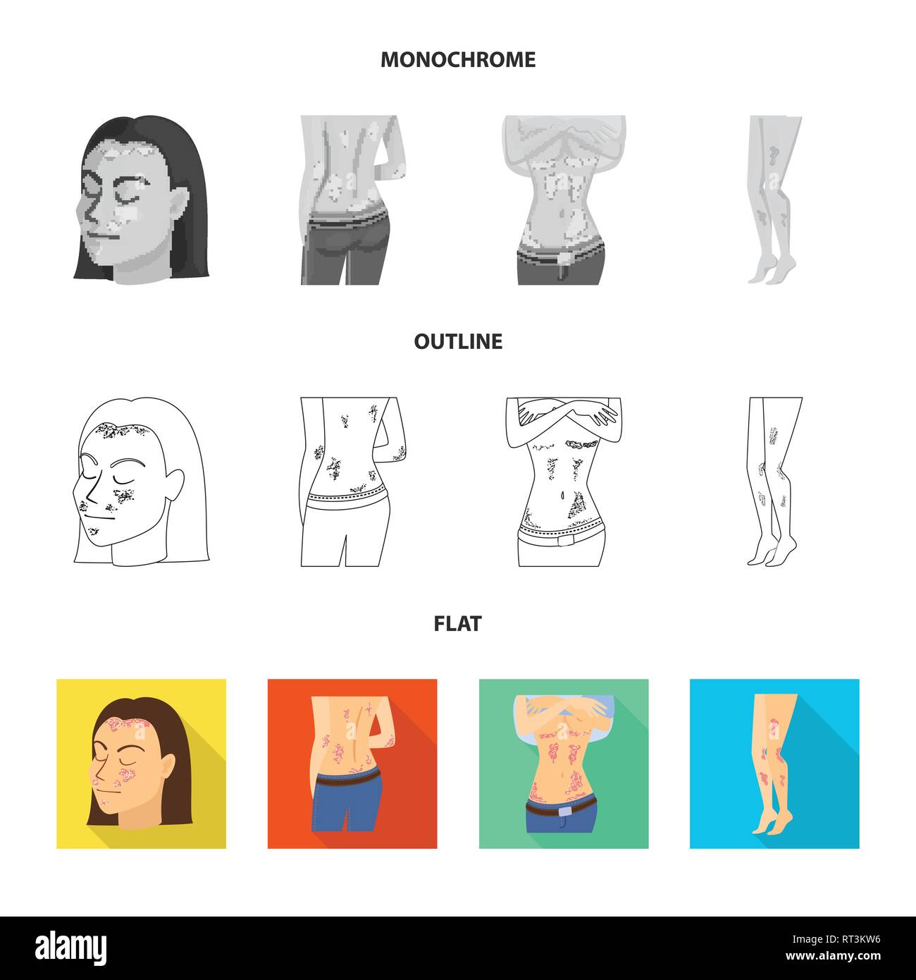 psoriasis,skin,body,chronic,allergy,eczema,itch,stress,rash,infection ...