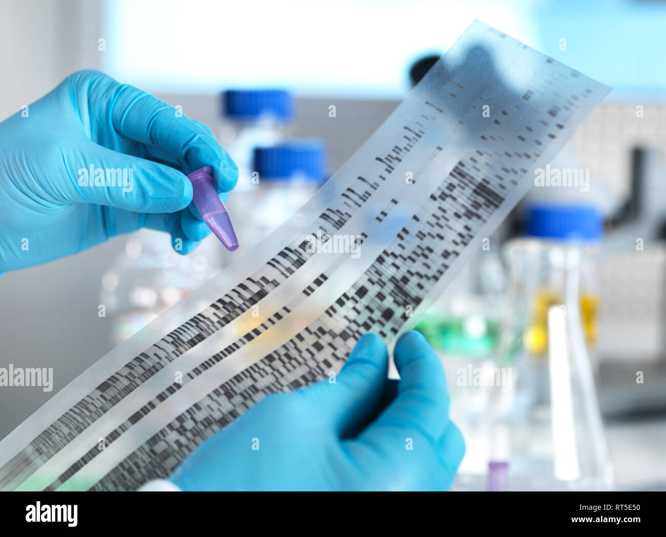 Dna autoradiogram hi-res stock photography and images - Alamy