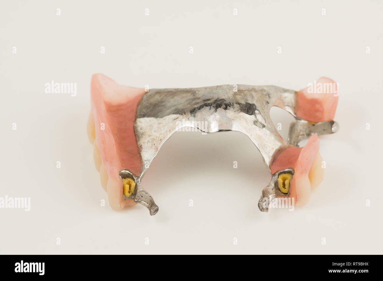 bugel remove dentures with attachments on white background Stock Photo ...