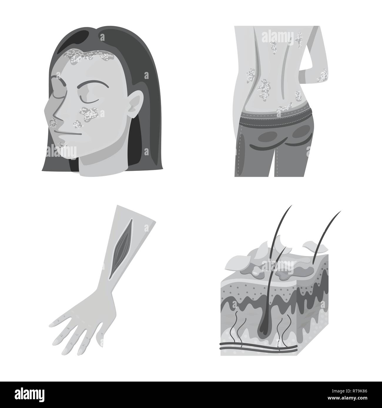 Back peeling Stock Vector Images - Alamy