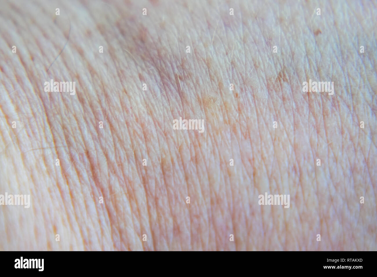 Skin bruise texture hi-res stock photography and images - Alamy
