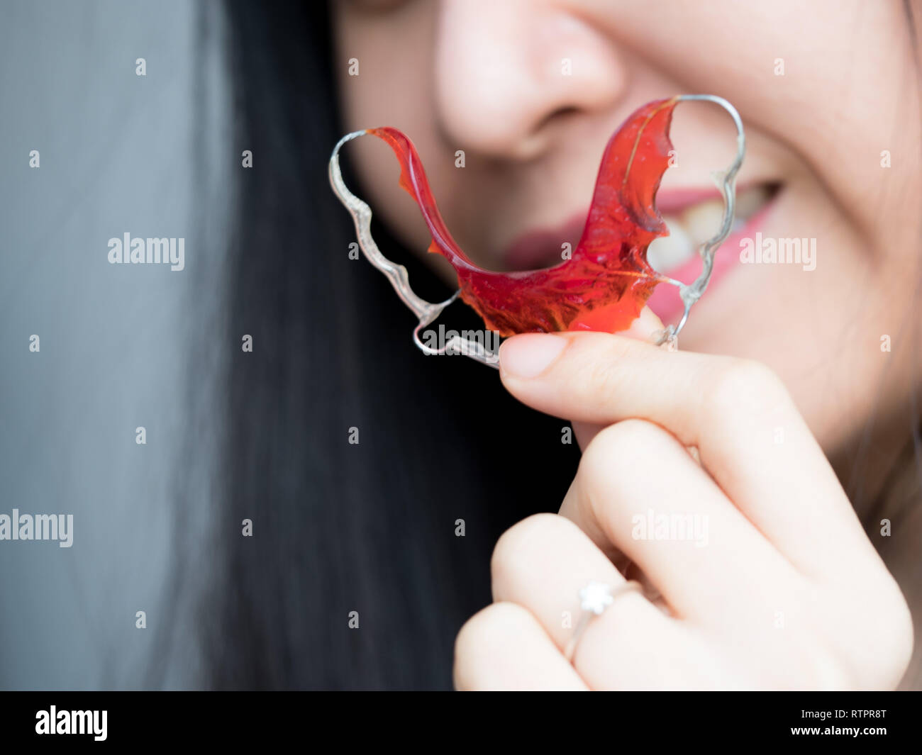 Portrait of beautiful Asian patient woman holding orthodontic retainers ...