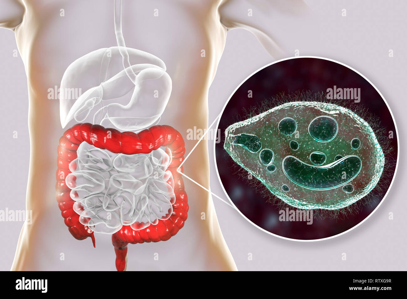 Balantidium coli hi-res stock photography and images - Alamy