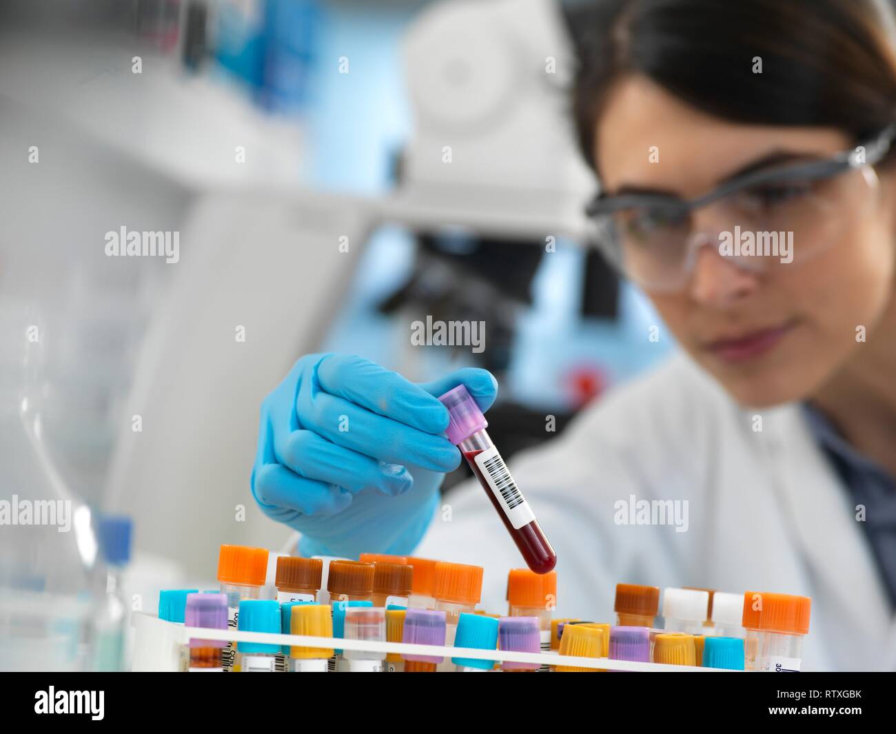 Haematological pathology hi-res stock photography and images - Alamy