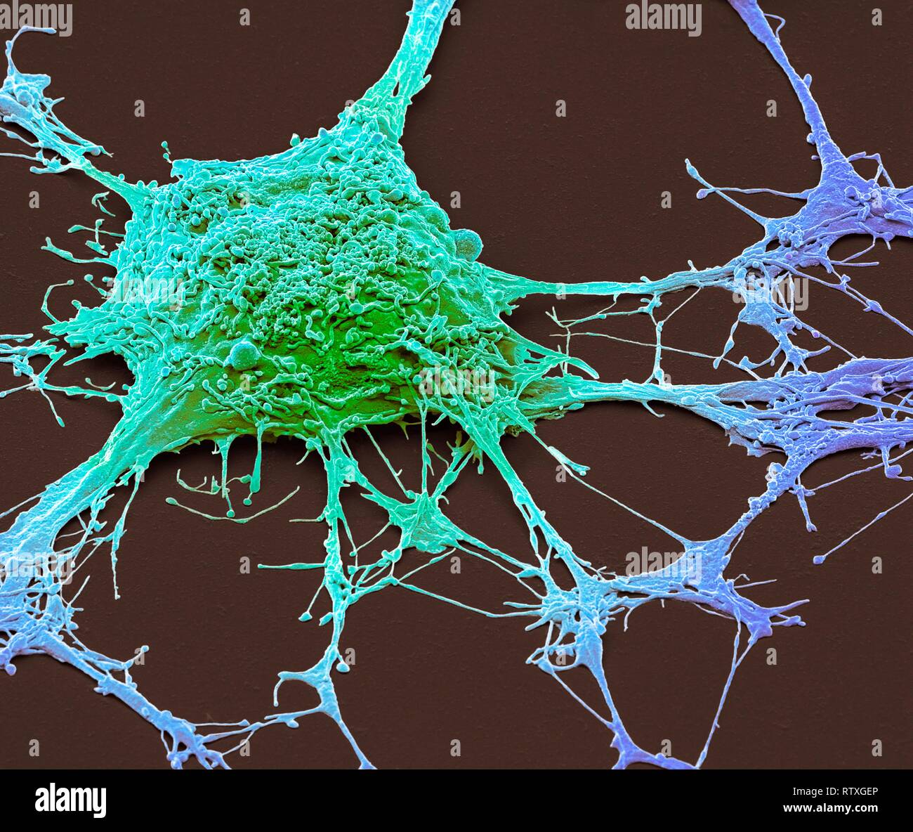 Neuron sem hi-res stock photography and images - Alamy