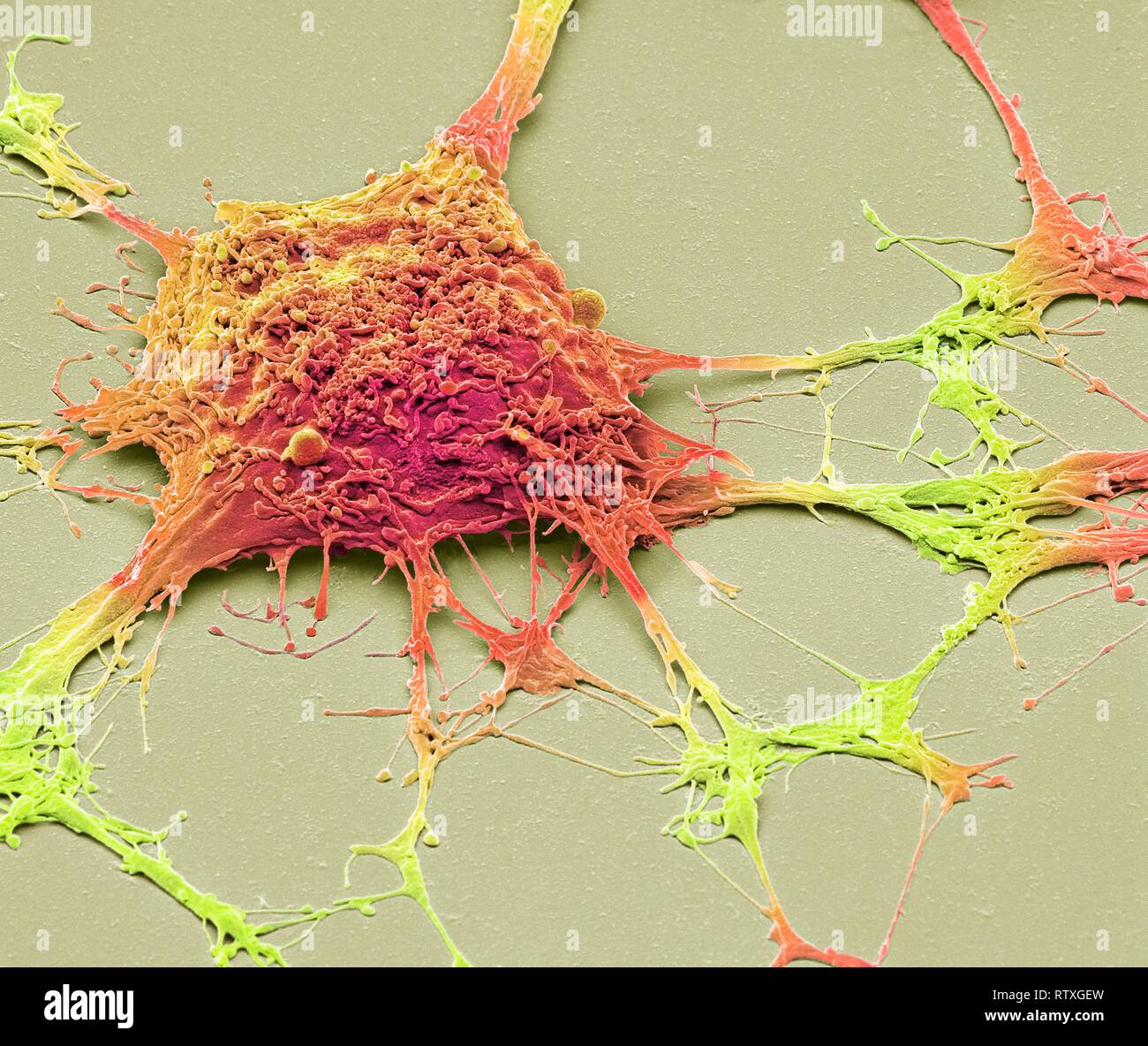 Rat brain anatomy hi-res stock photography and images - Alamy