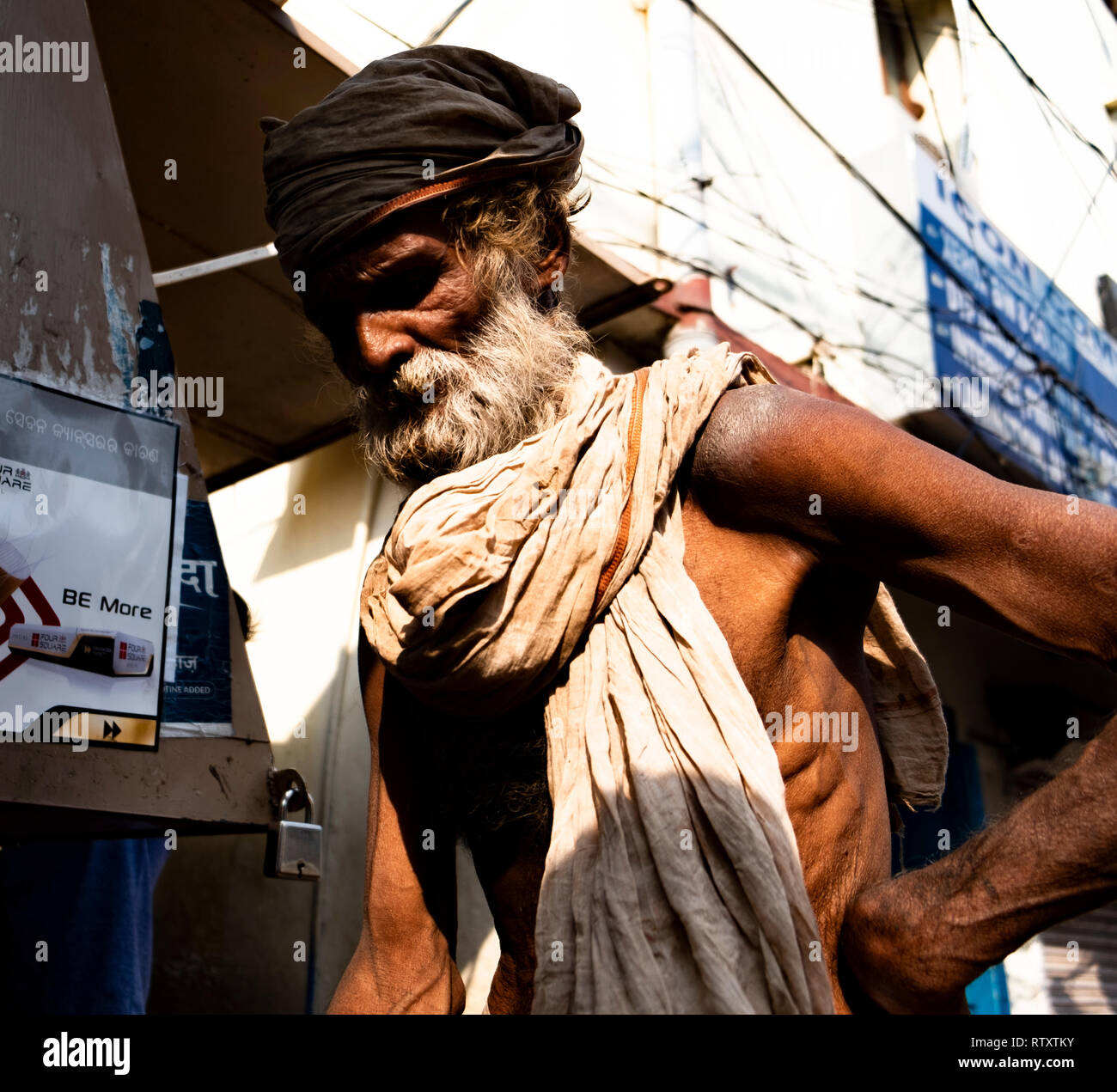 India malnutrition hi-res stock photography and images - Alamy