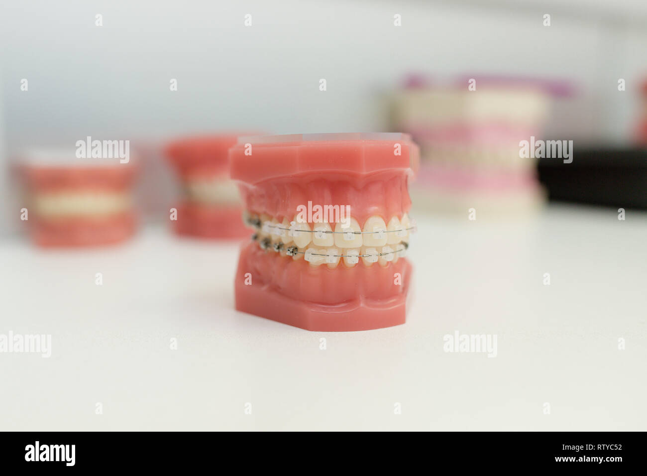 Orthodontic Model - White teeth with braces. Human jaw. Dentistry ...