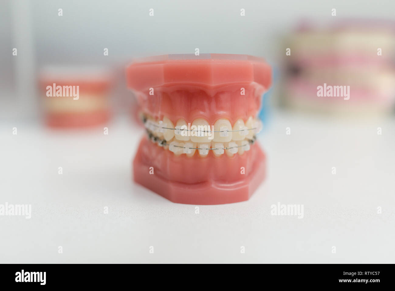 Orthodontic Model - White teeth with braces. Human jaw. Dentistry ...