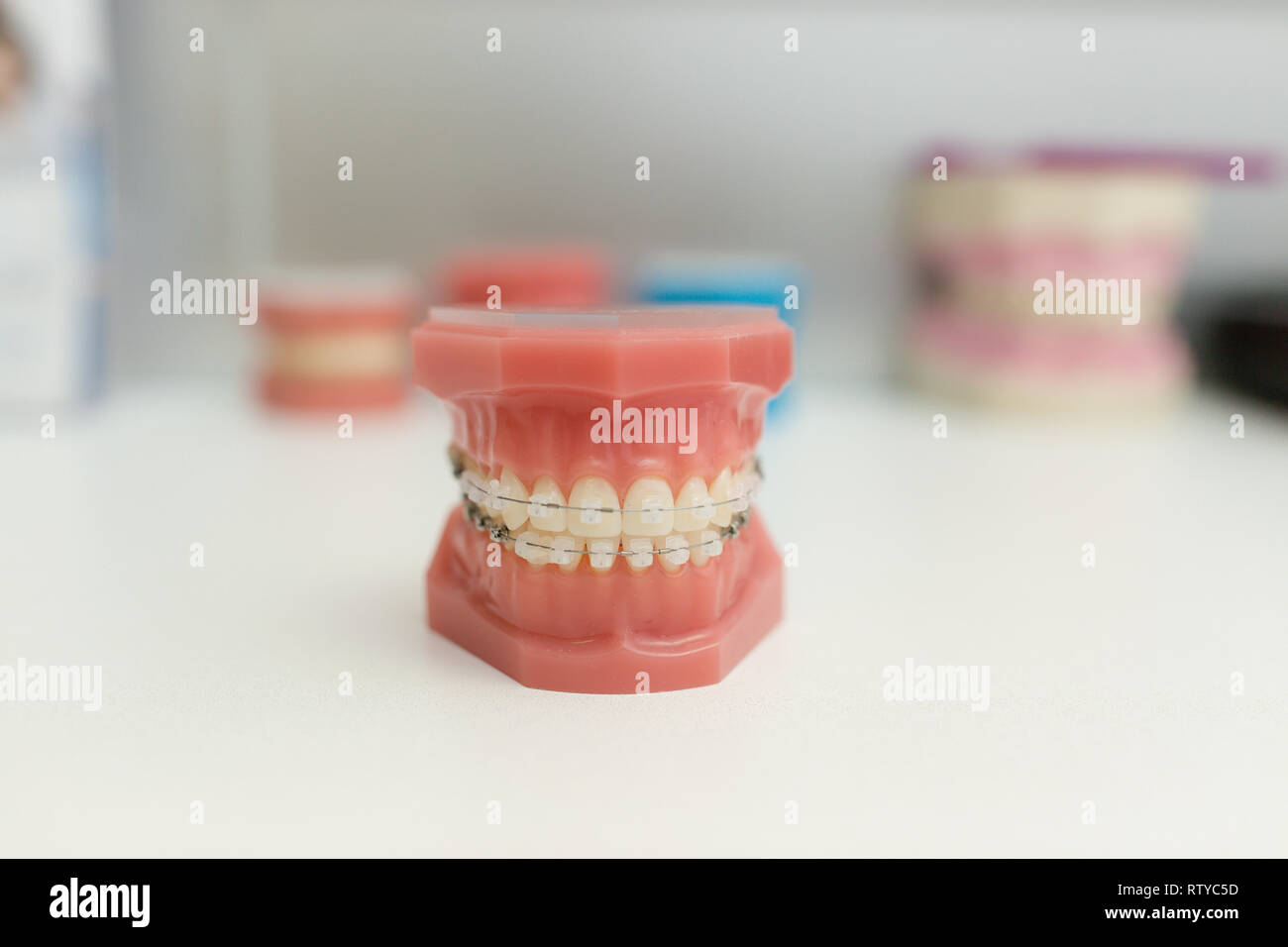 Orthodontic Model - White teeth with braces. Human jaw. Dentistry ...