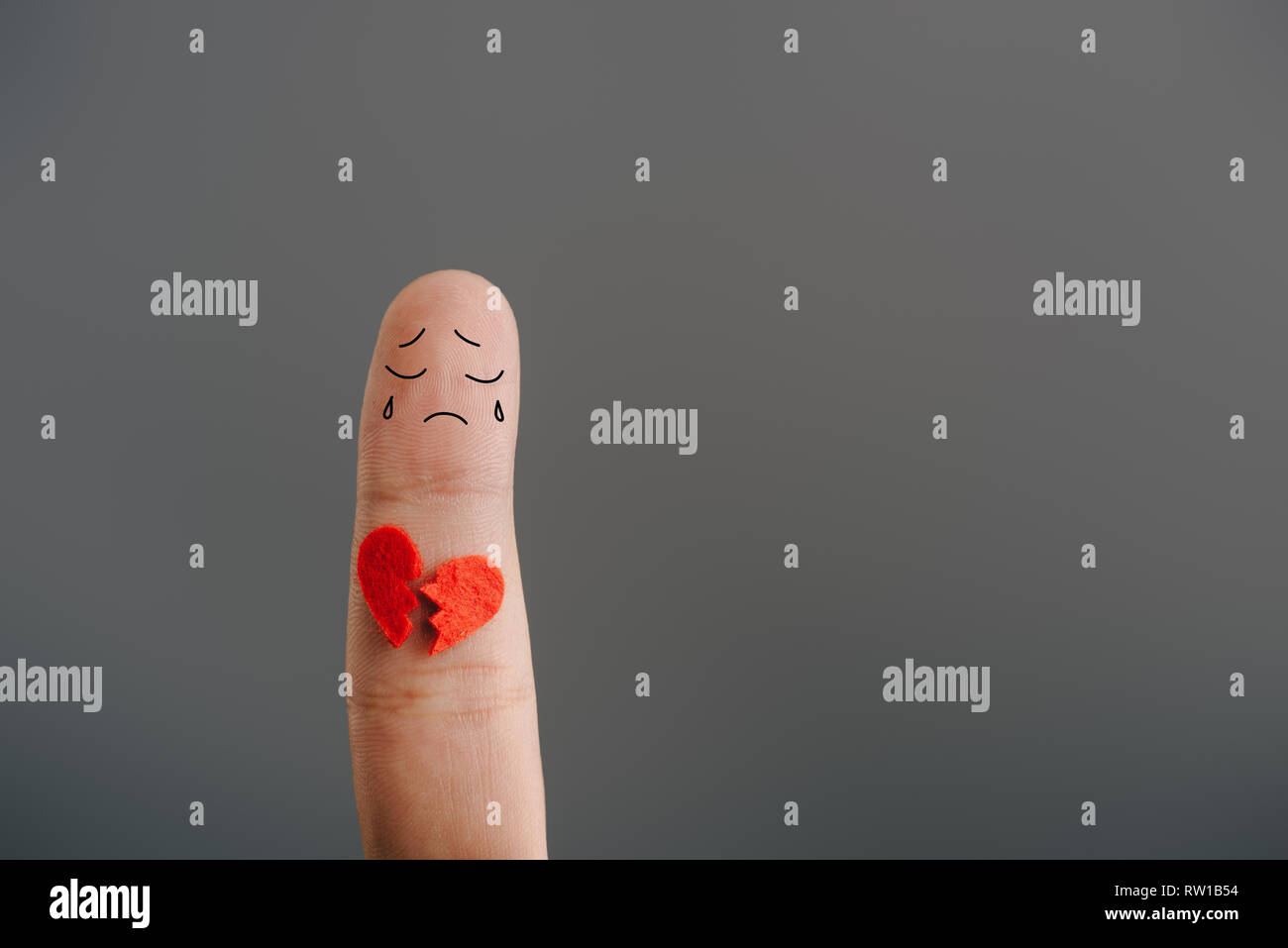Finger broken hi-res stock photography and images - Alamy
