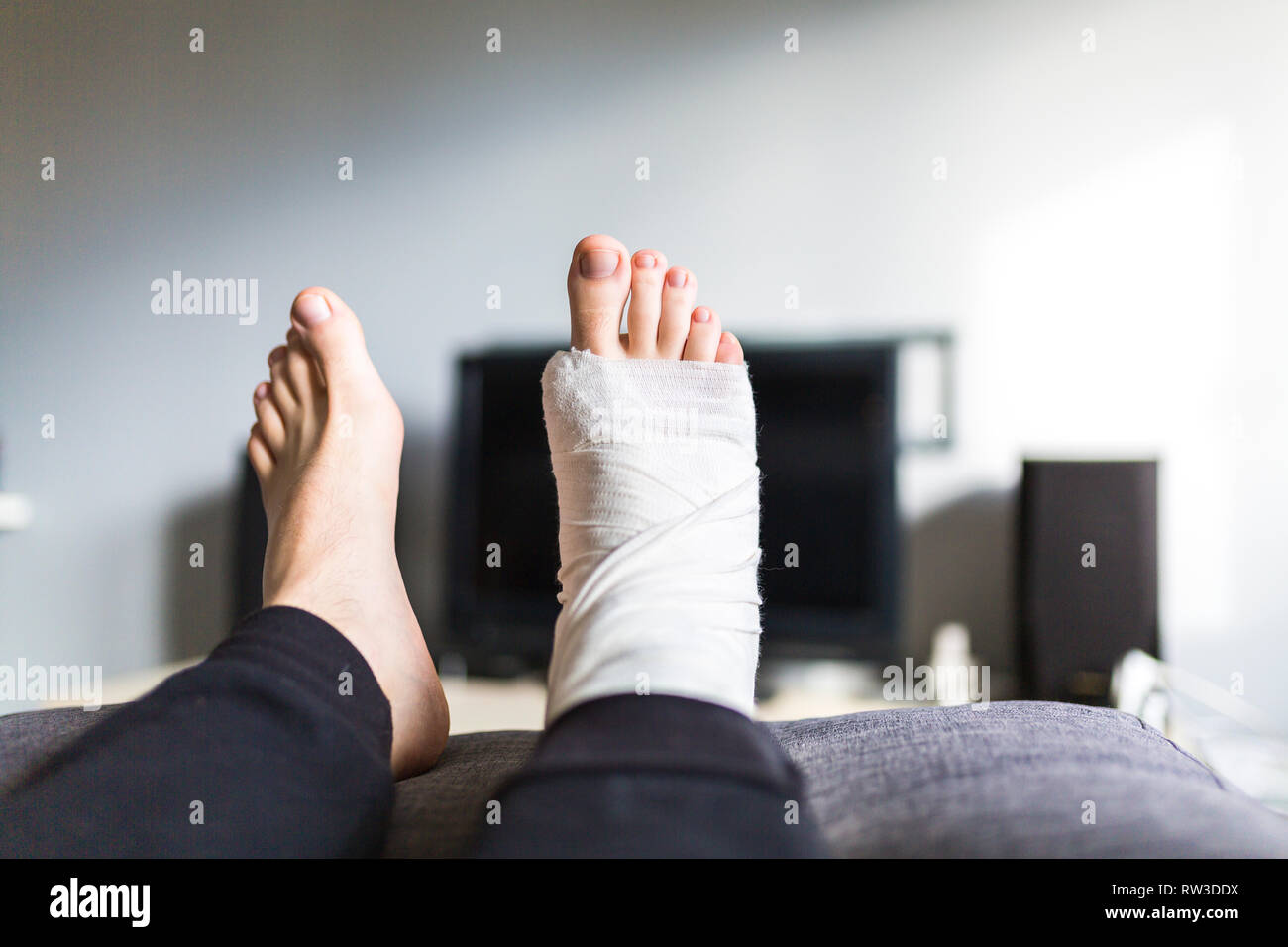 With a broken leg hi-res stock photography and images - Alamy