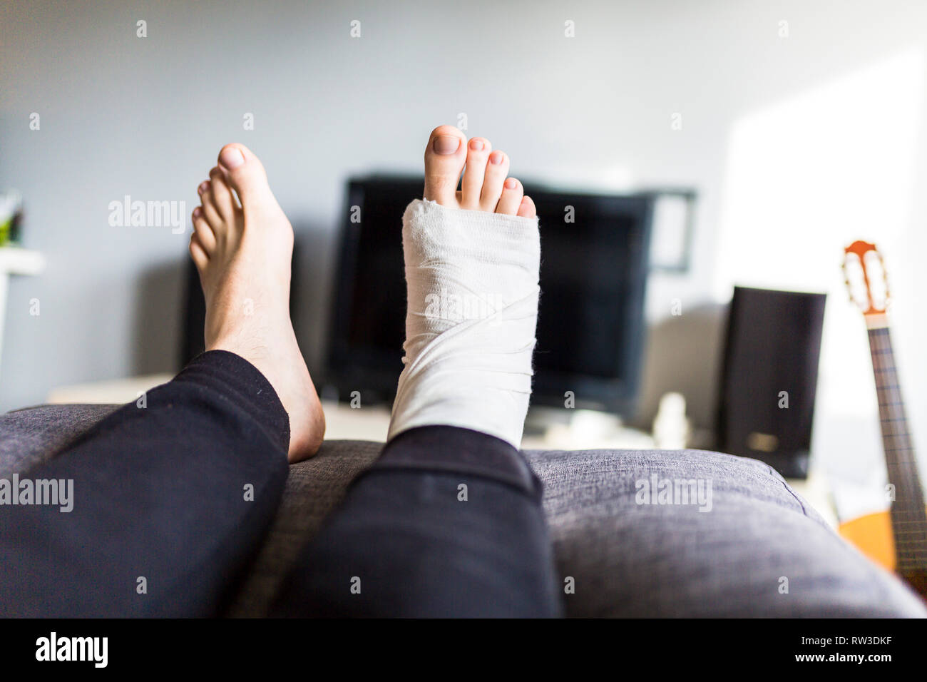 man in front of the TV with a broken leg Stock Photo - Alamy