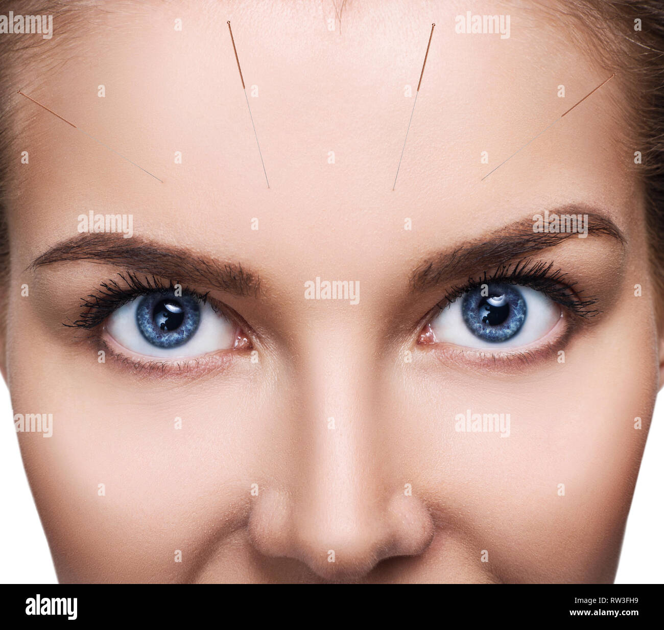 Acupuncture points head hi-res stock photography and images - Alamy