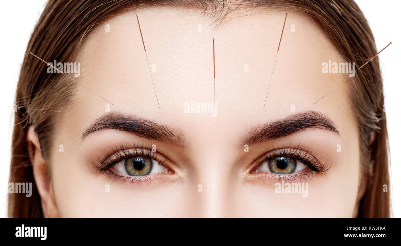 Acupuncture points head hi-res stock photography and images - Alamy