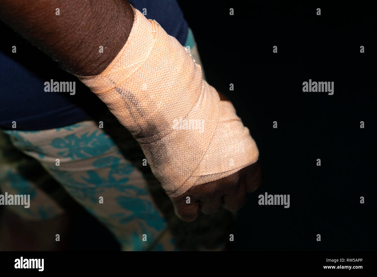 Black hand bandage hi-res stock photography and images - Alamy