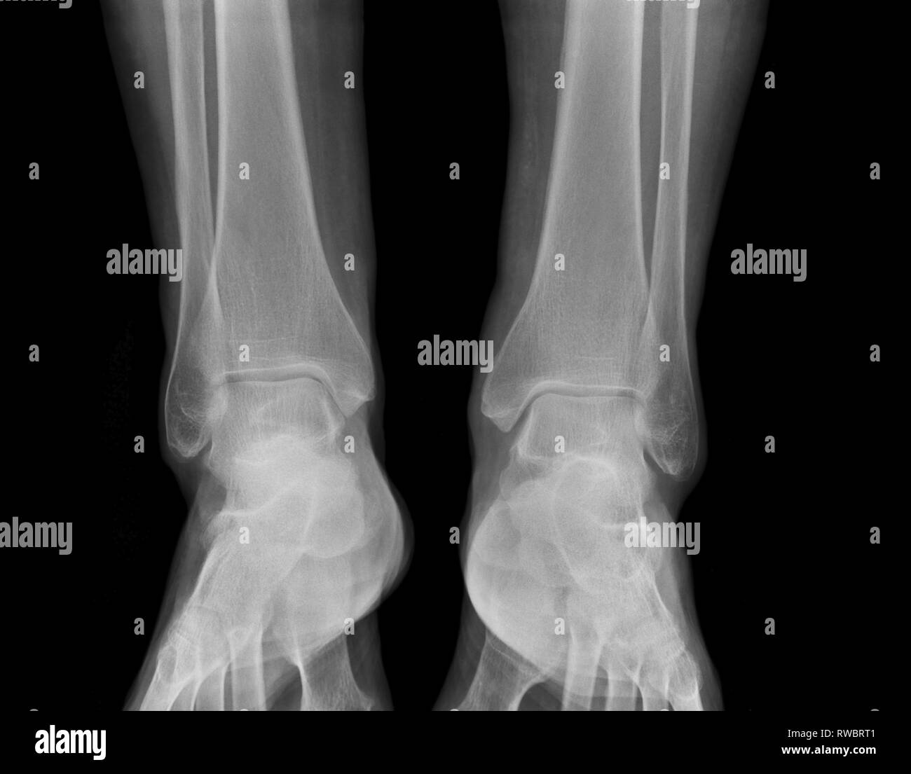 Human feet hi-res stock photography and images - Alamy