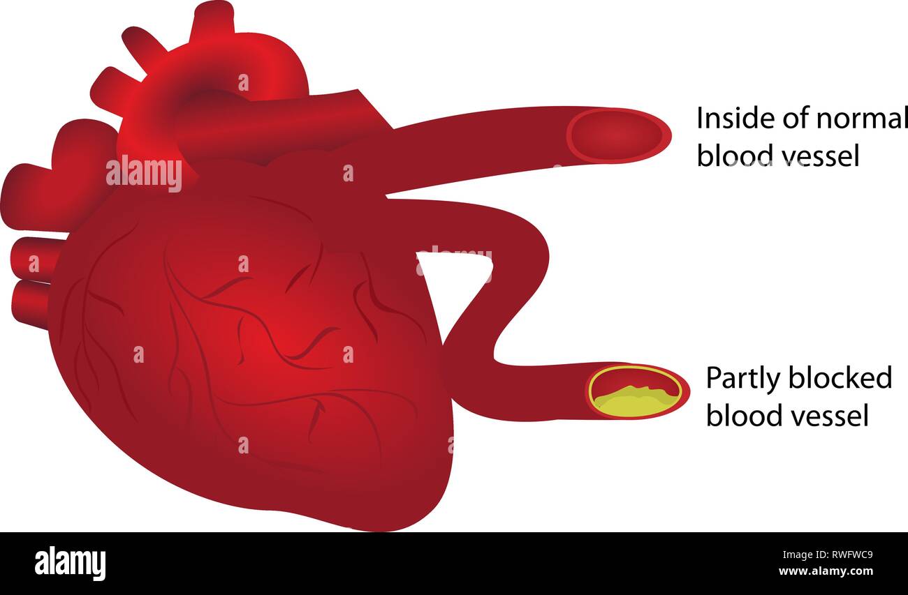 Normal heart stage Stock Vector Images - Alamy