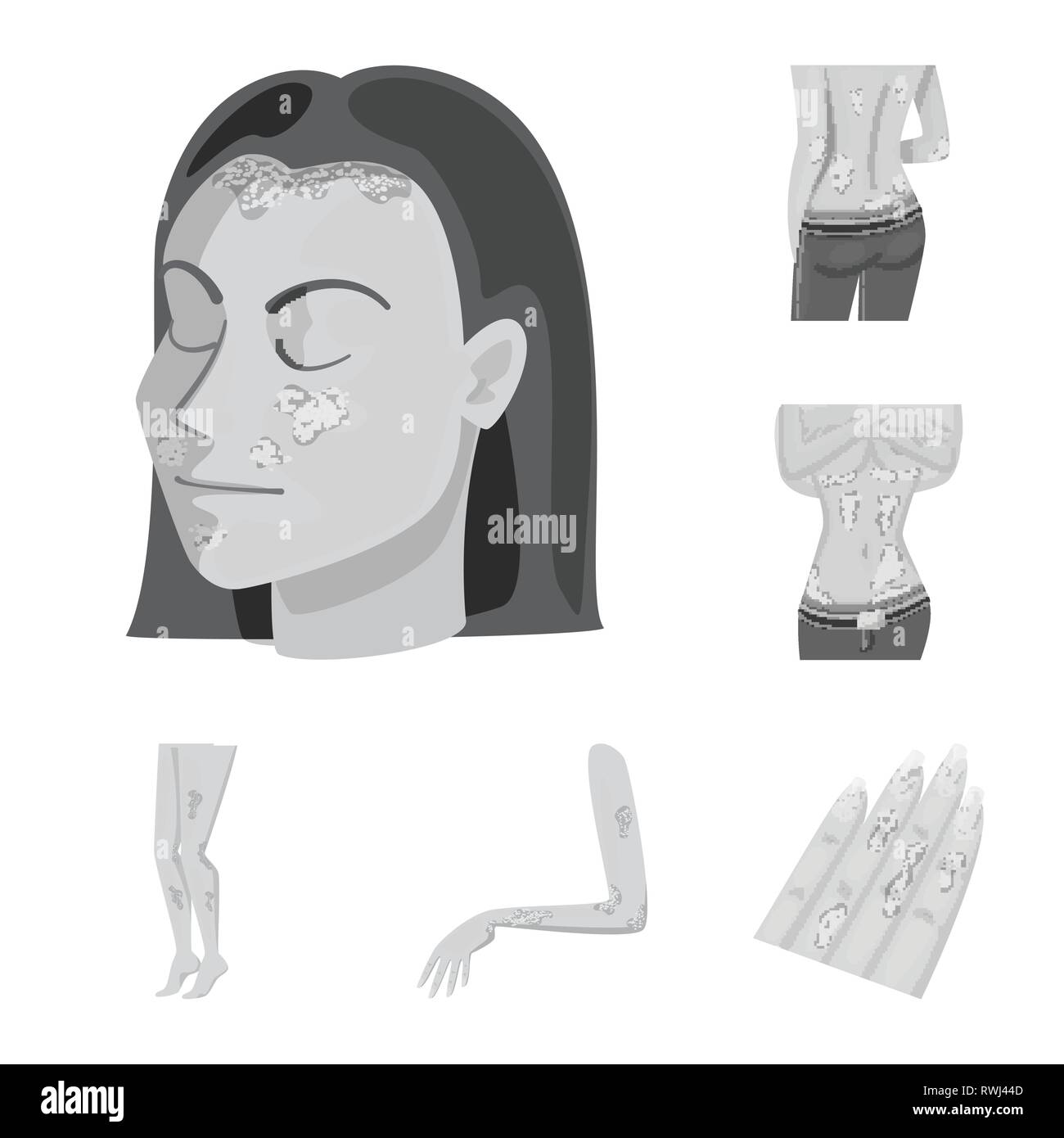 Back peeling Stock Vector Images - Alamy