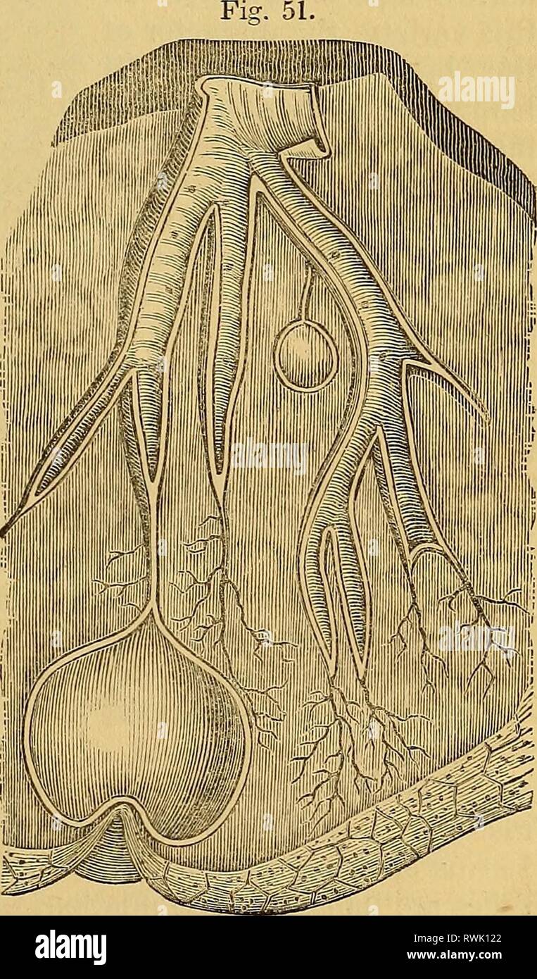 Elements of pathological anatomy (1843 Stock Photo - Alamy