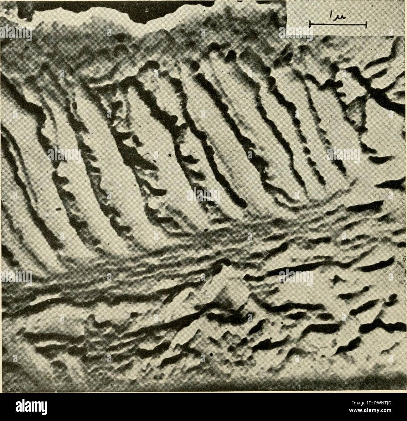 The electron microscope, its development, The electron microscope, its ...