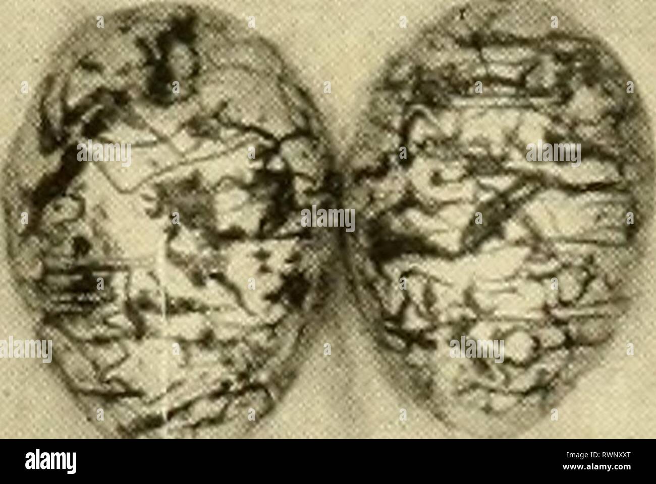 The Emu official organ Stock Photo - Alamy