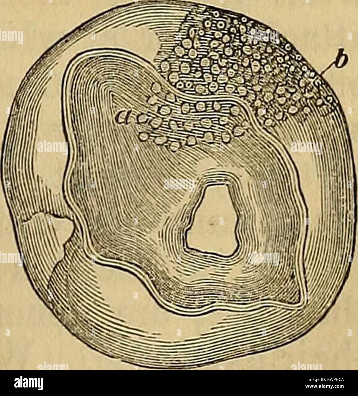 Elements of pathological anatomy (1843 Stock Photo - Alamy