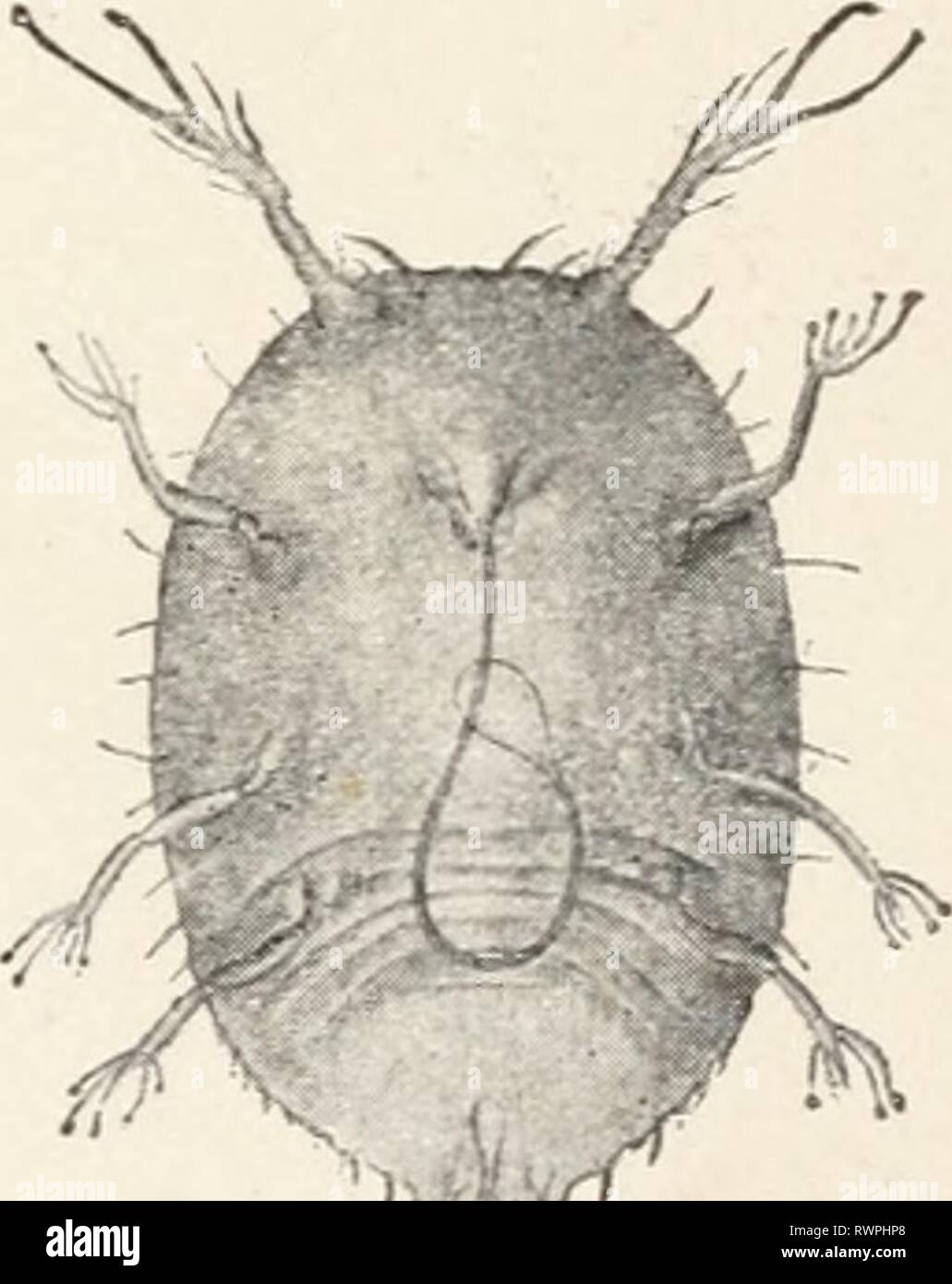 Enlarged Abdomen High Resolution Stock Photography and Images - Alamy