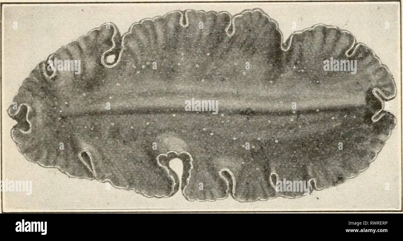 Leech mouth hi-res stock photography and images - Alamy