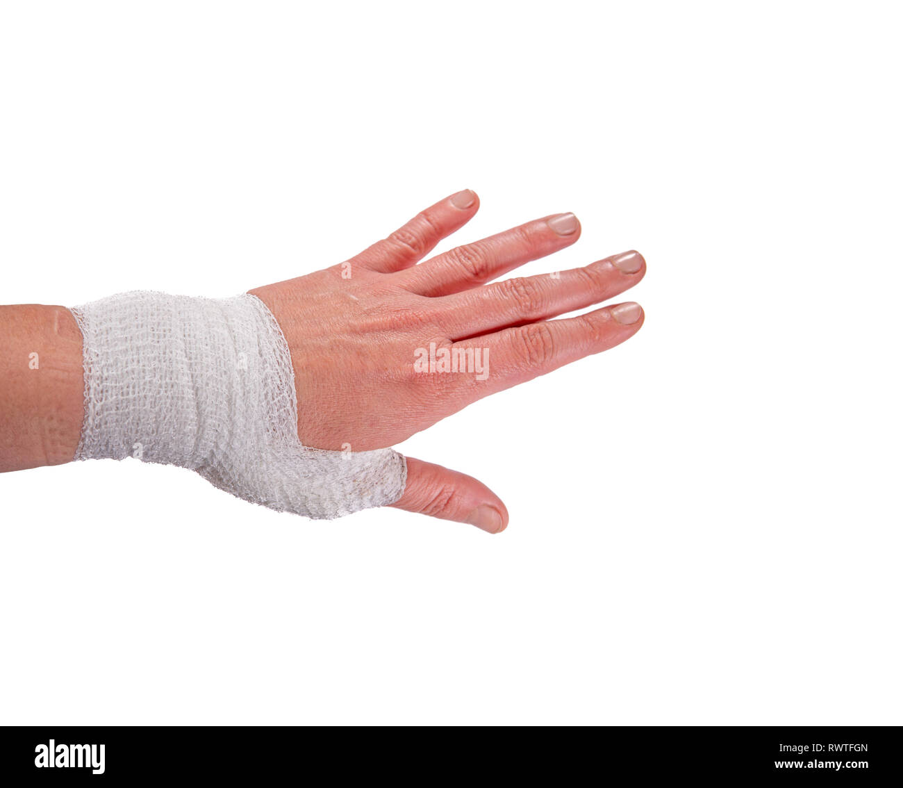 Left hand injury hi-res stock photography and images - Alamy