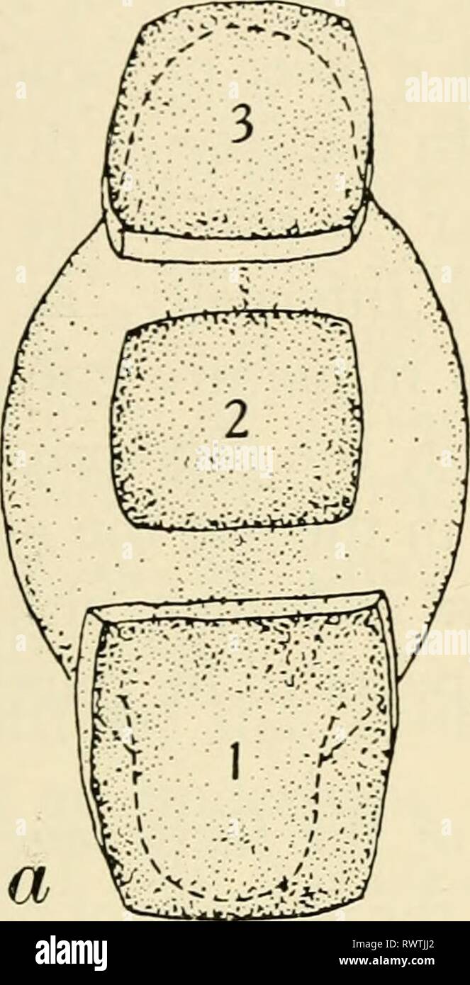 Appendix cross section hi-res stock photography and images - Alamy